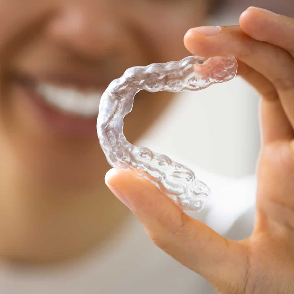 Invisalign® Braces | Stilly Valley Dental